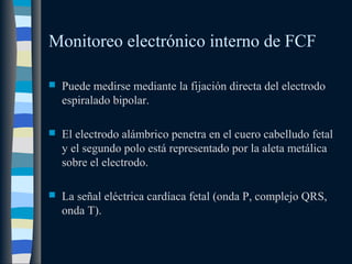 Maniobras de leopold | PPT