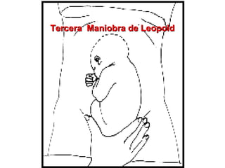 Maniobras De Parto[1] | PPT