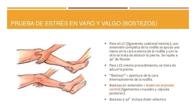 Maniobras en la exploración de rodilla
