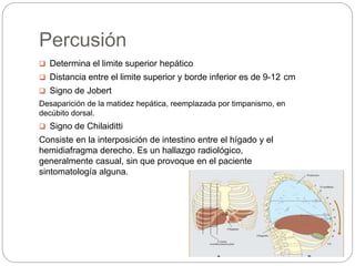MANIOBRAS SEMIO II ABDOMINAL.pptx