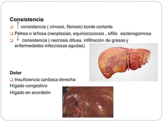 MANIOBRAS SEMIO II ABDOMINAL.pptx