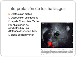 MANIOBRAS SEMIO II ABDOMINAL.pptx