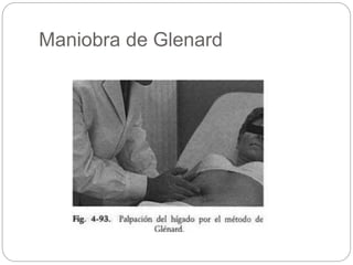 MANIOBRAS SEMIO II ABDOMINAL.pptx