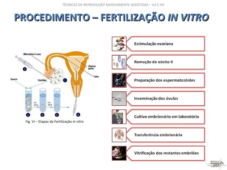 Manipulação da fertilidade_-_infertilidade_humana_e_reprodução_assist…