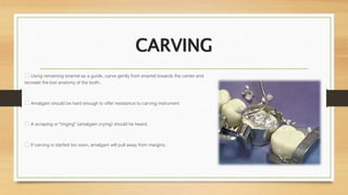MANIPULATION OF AMALGAM.pptx