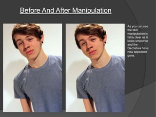 Manipulation of skin | PPTX