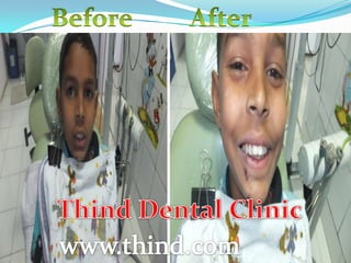 Thind Dental Clinic | PPTX