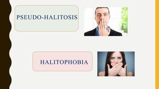 oral malodour/ halitosis | PPTX