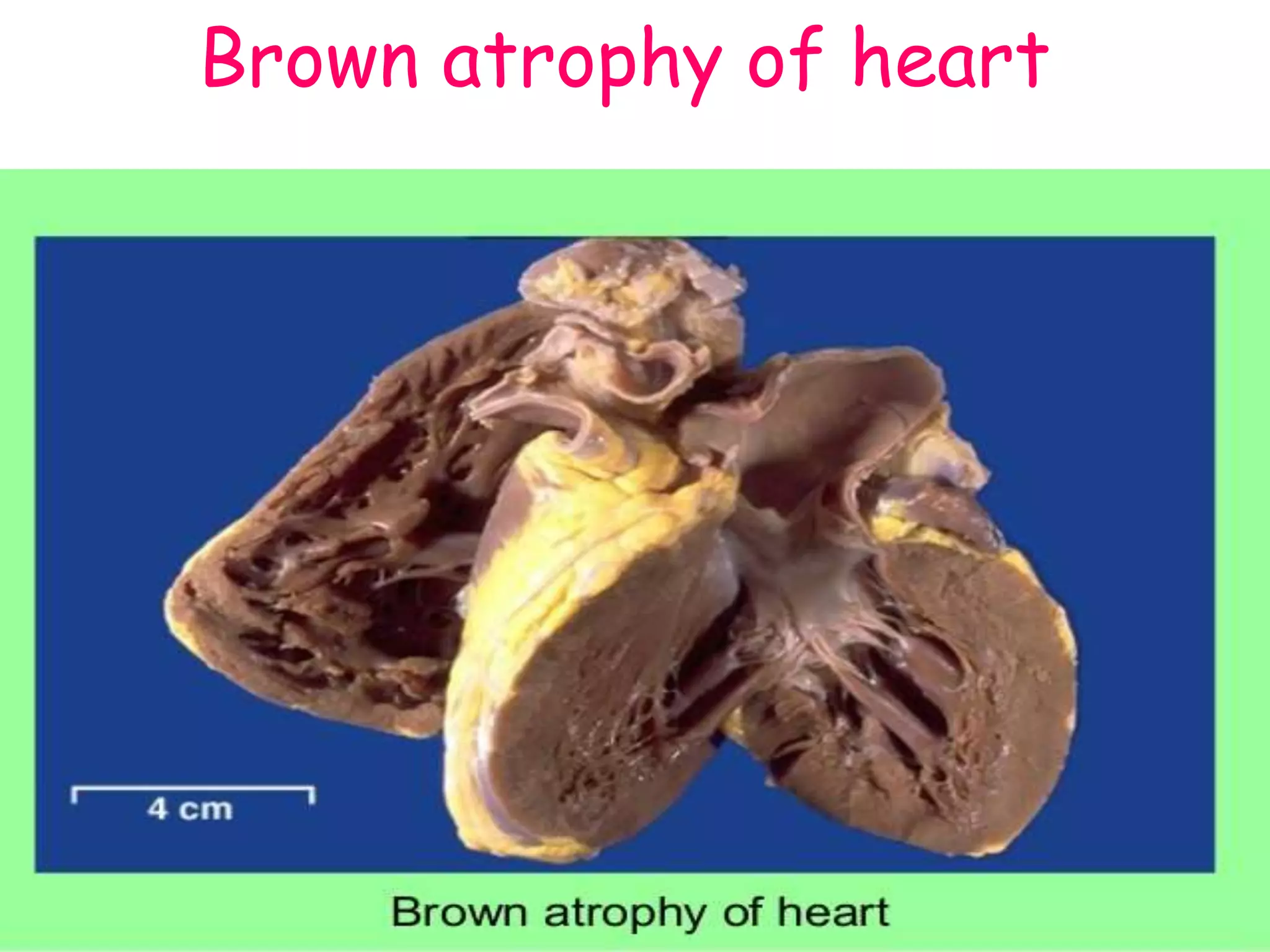 pathological anatomy | PPTX