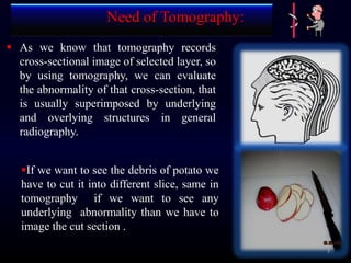 tomography tomography - Presentation Transcript 1. PRINCIPLE ...