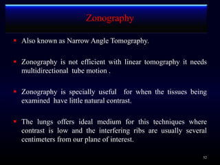 tomography tomography - Presentation Transcript 1. PRINCIPLE ...