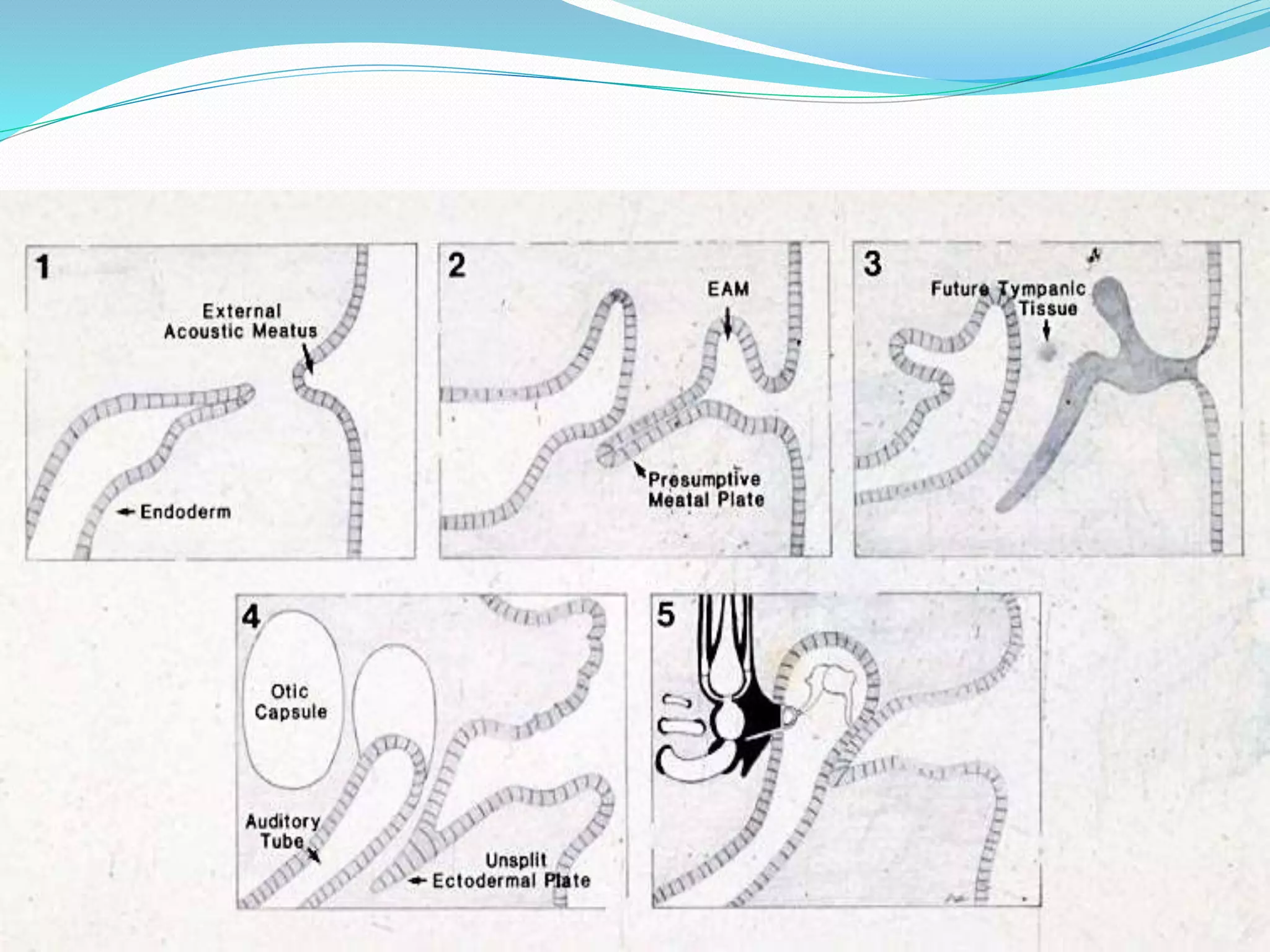 EMBRYOLOGY AND MALFORMATION OF EAR | PPTX