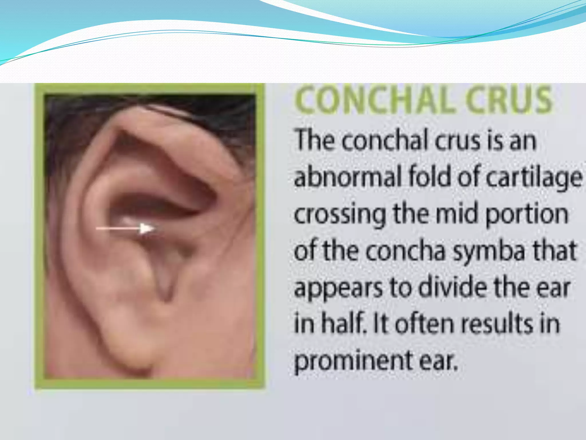 EMBRYOLOGY AND MALFORMATION OF EAR | PPTX