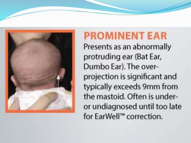 EMBRYOLOGY AND MALFORMATION OF EAR | PPTX