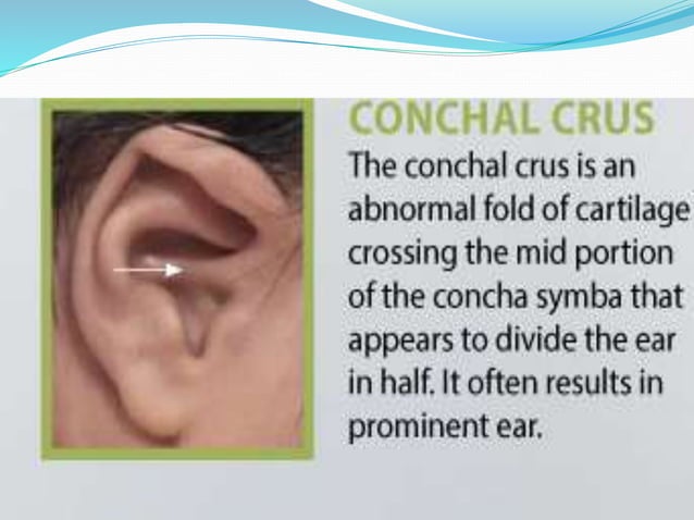 EMBRYOLOGY AND MALFORMATION OF EAR | PPTX