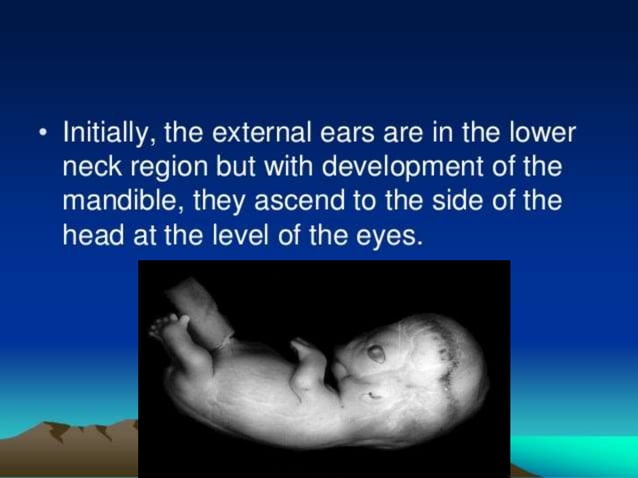 EMBRYOLOGY AND MALFORMATION OF EAR | PPTX