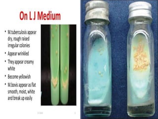 Myco.tuberculosis | PPTX