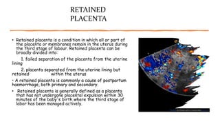 mannual removal of placenta.pptx