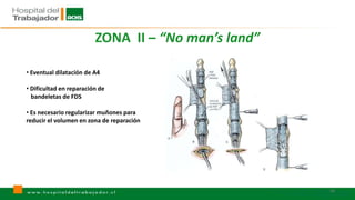 Lesión de Tendones Flexores | PPTX