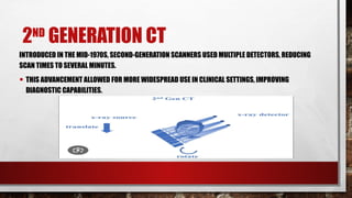 Computer tomography history and its generation | PPTX