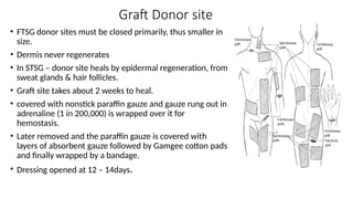 Plastic surgery introduction (Grafts and Flaps).pptx
