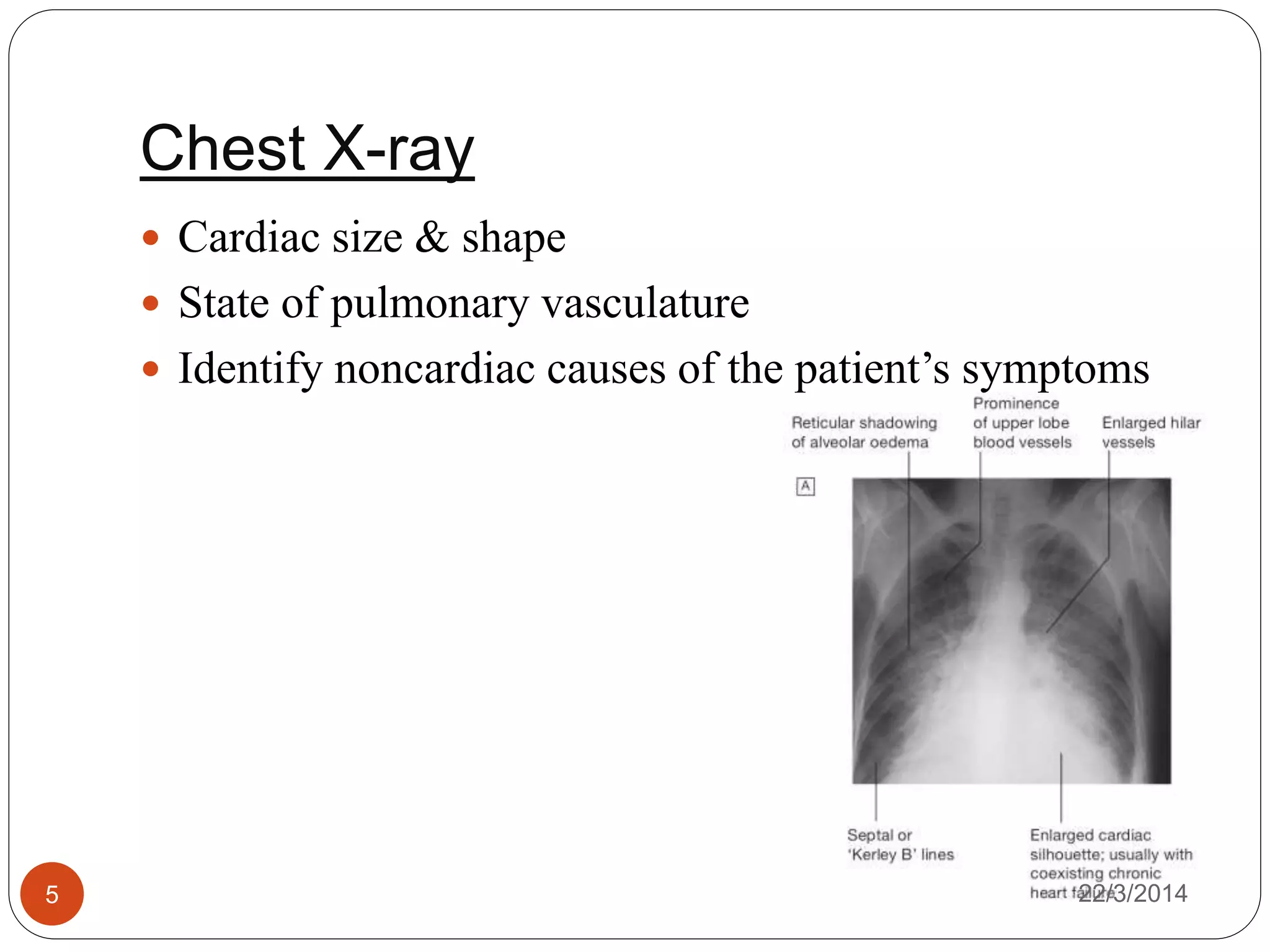 Heart Failure - Diagnosis and Differential Diagnosis | PPTX