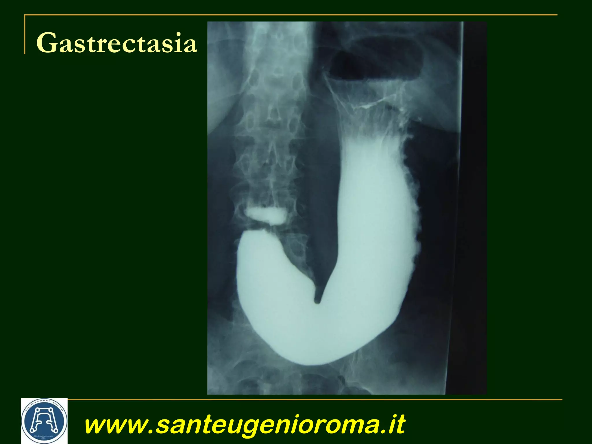 Lisi D. Il ruolo dell'infermiere in endoscopia digestiva | PPT