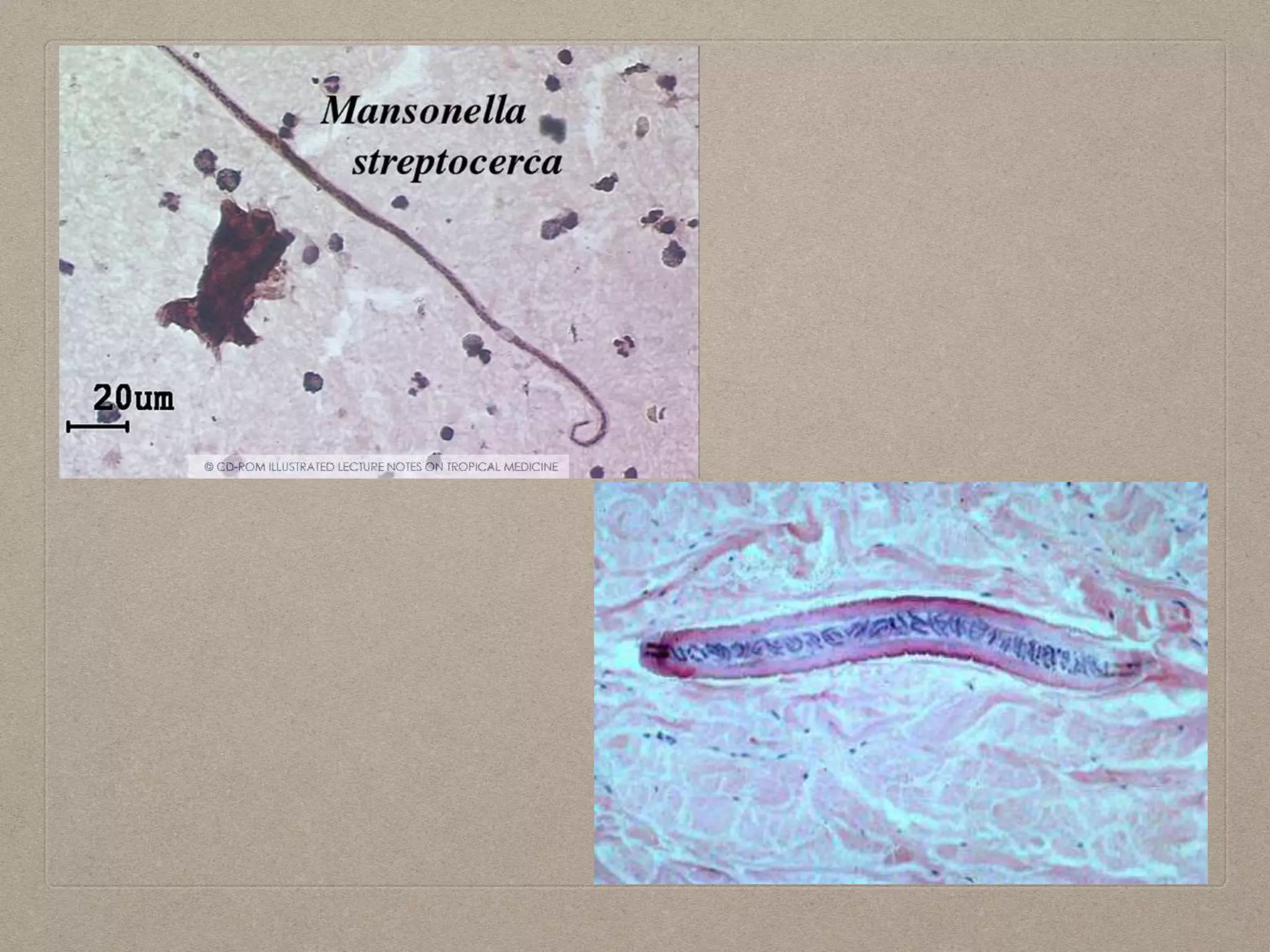 Mansonella streptocerca | PPTX