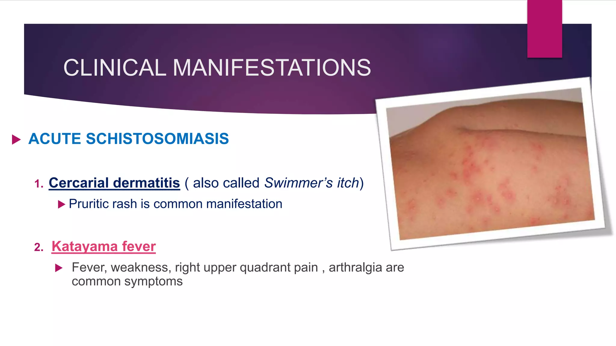 Schistosoma Mansoni and Schistosoma japonicum | PPTX