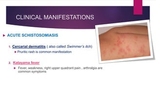 Schistosomiasis Rash