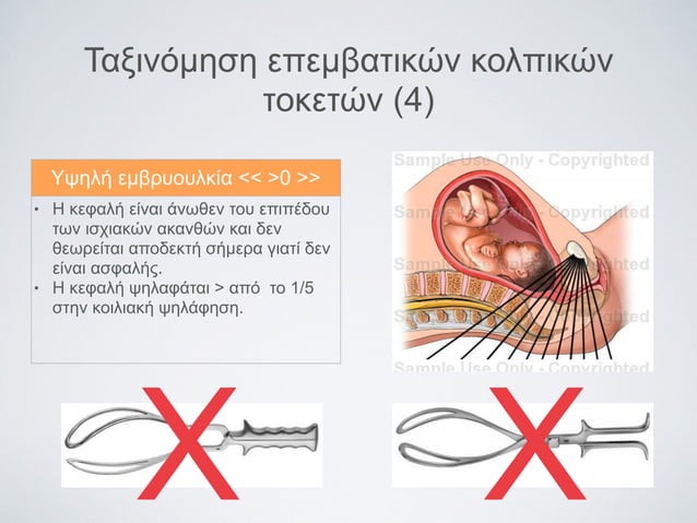 Instrumental delivery | PDF