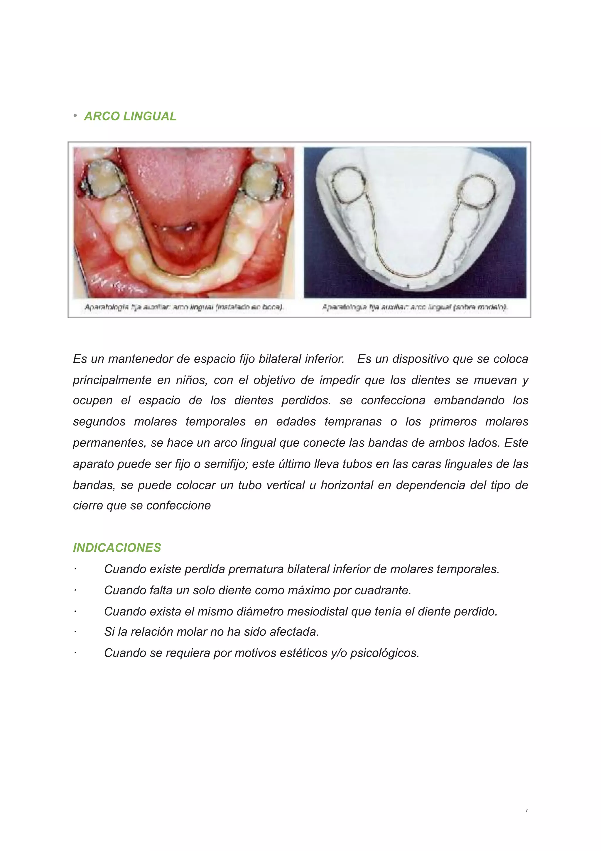 Mantenedores de Espacio odontopediatria | PDF