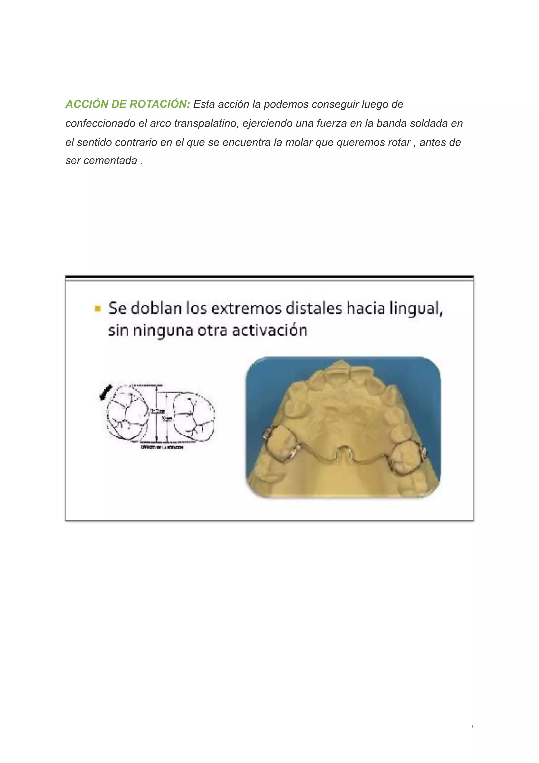 Mantenedores de Espacio odontopediatria | PDF