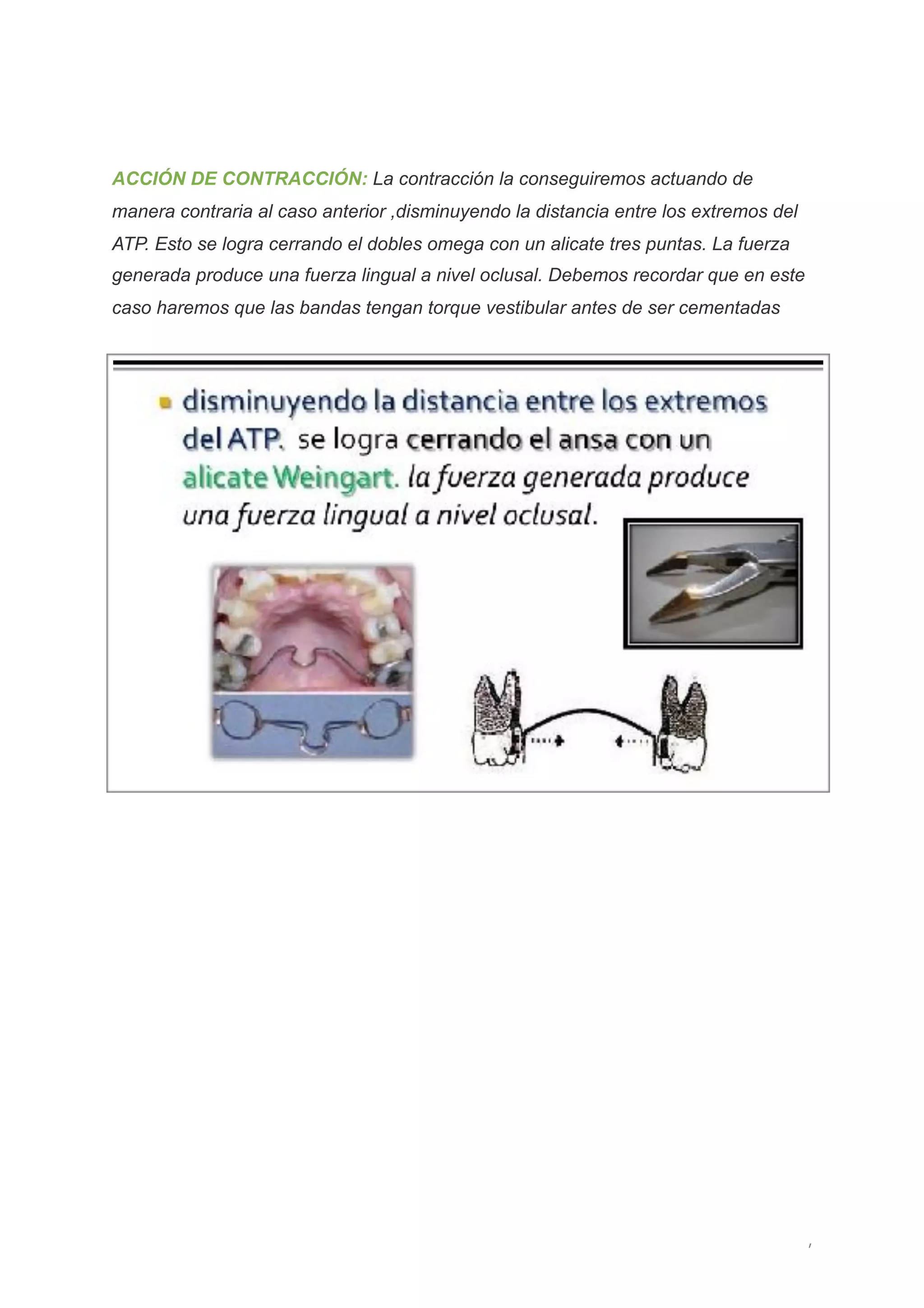 Mantenedores de Espacio odontopediatria | PDF