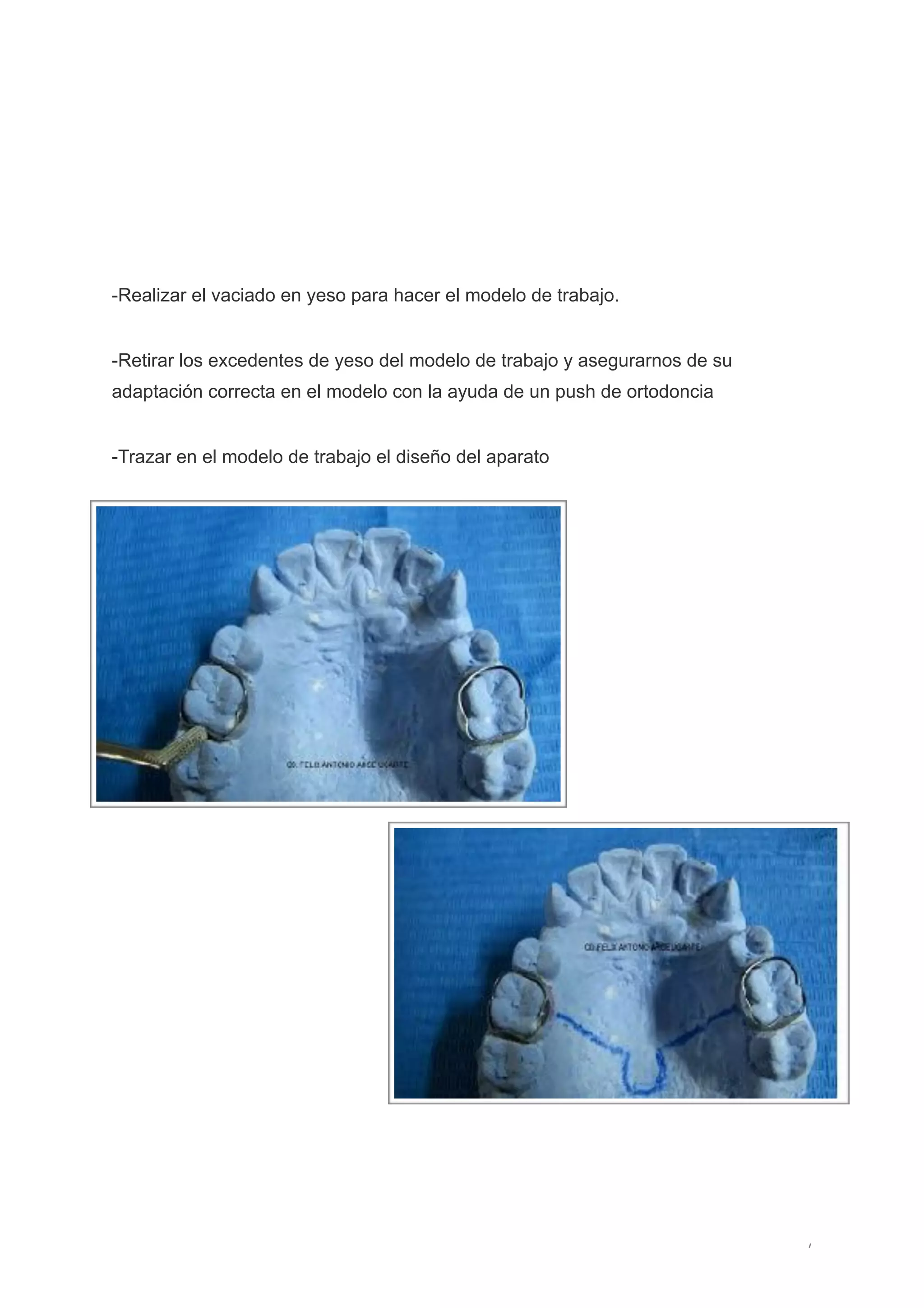 Mantenedores de Espacio odontopediatria | PDF