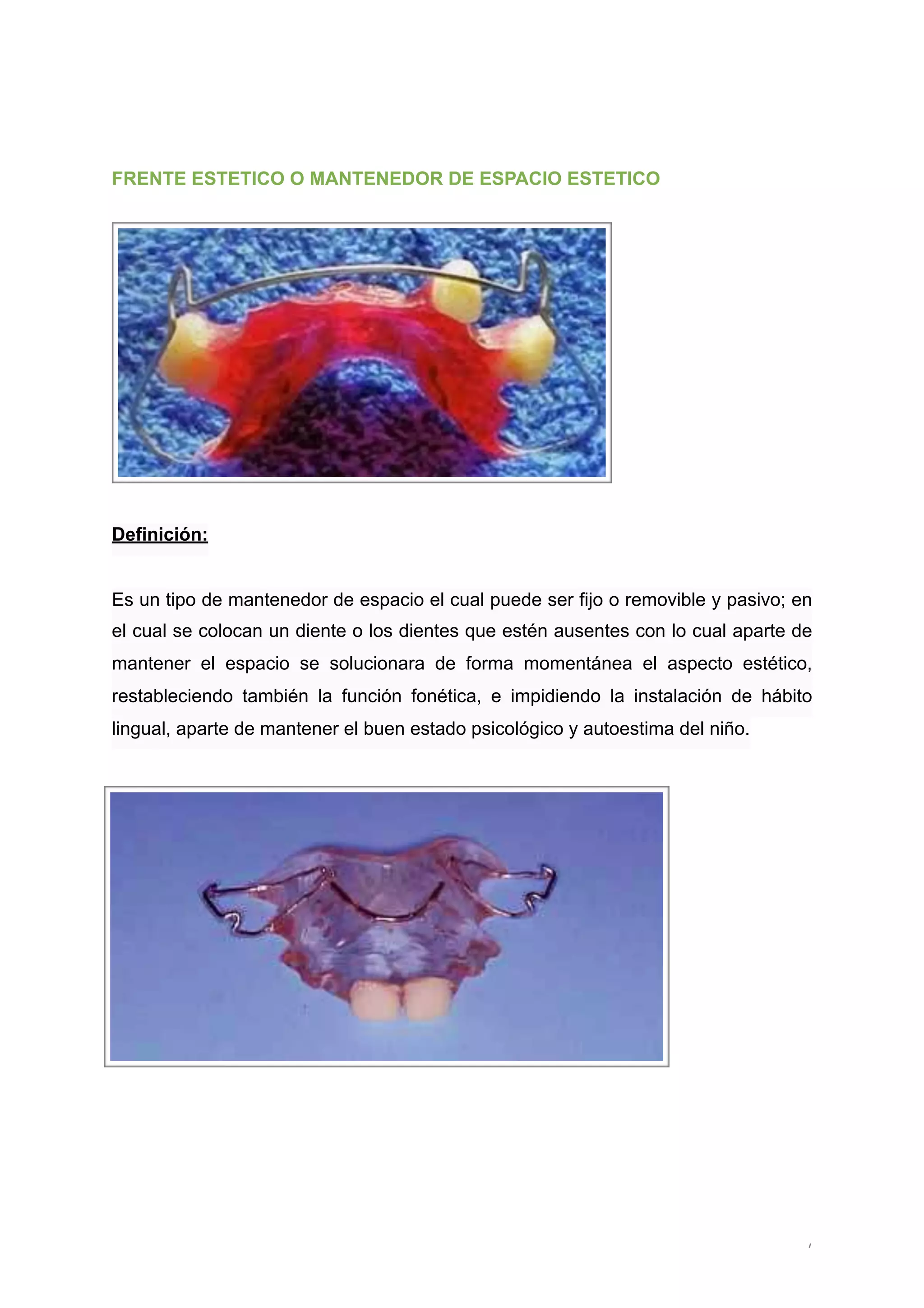 Mantenedores de Espacio odontopediatria | PDF