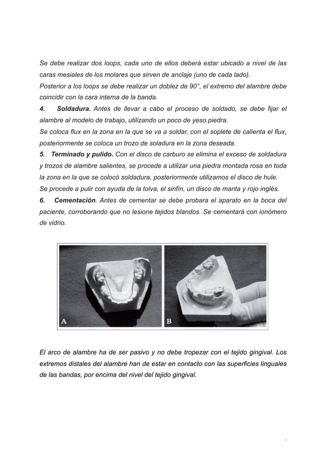 Mantenedores de Espacio odontopediatria | PDF