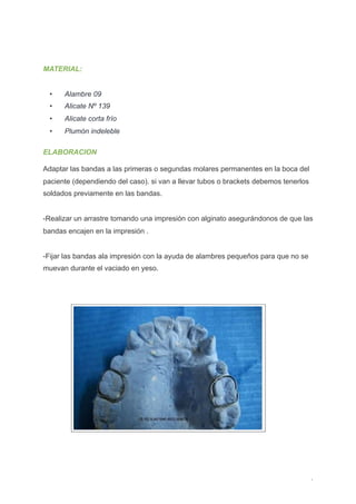 Mantenedores de Espacio odontopediatria | PDF