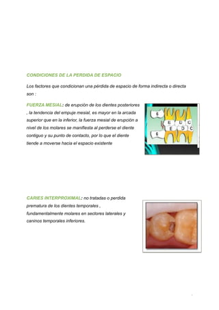Mantenedores de Espacio odontopediatria | PDF