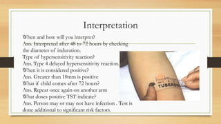 Mantoux, BCG scar-1.pptx | Infectious Diseases | Diseases and Conditions