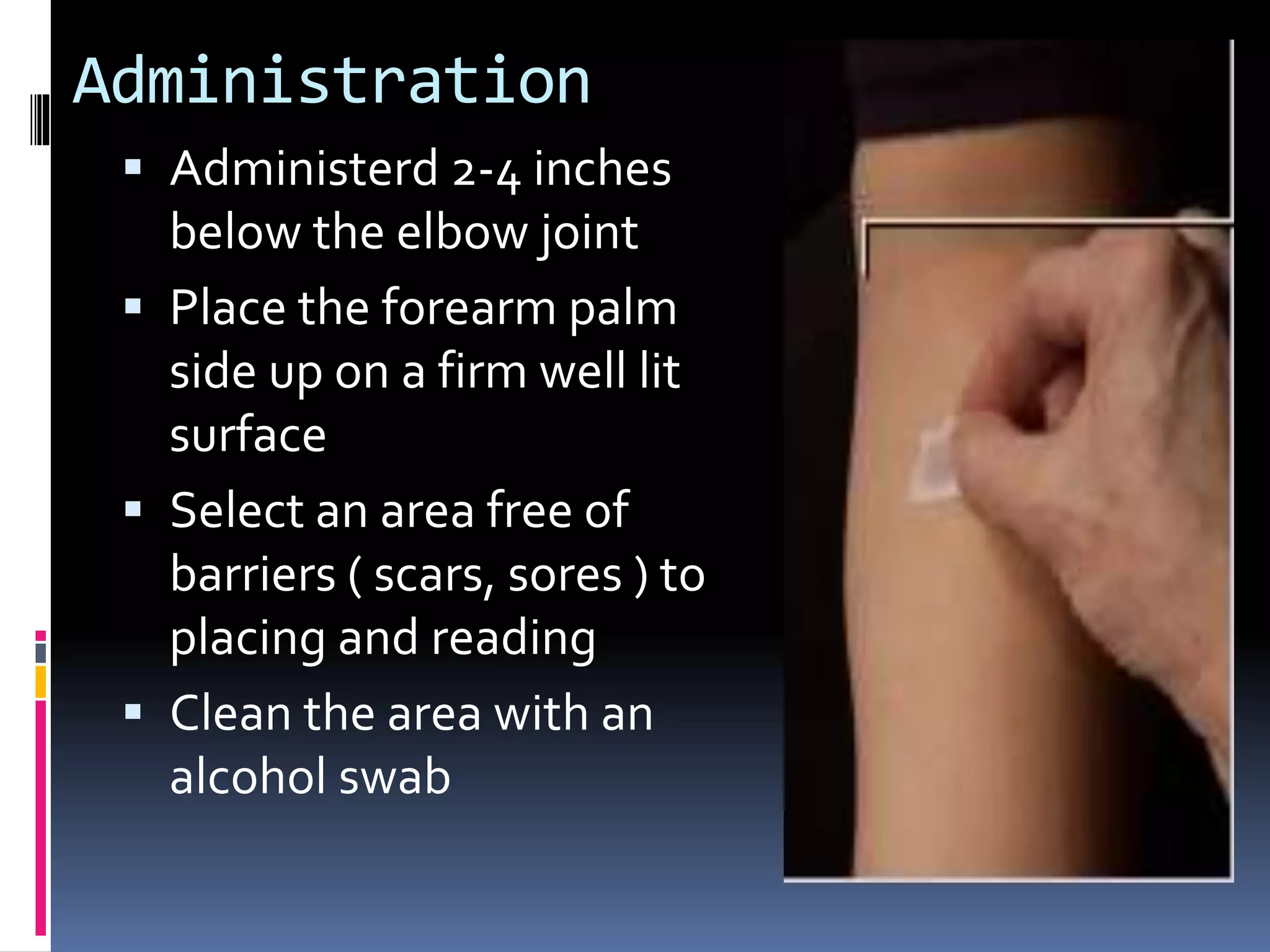 Mantoux | PPTX