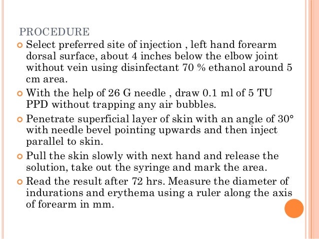Mantoux Test mantoux-test