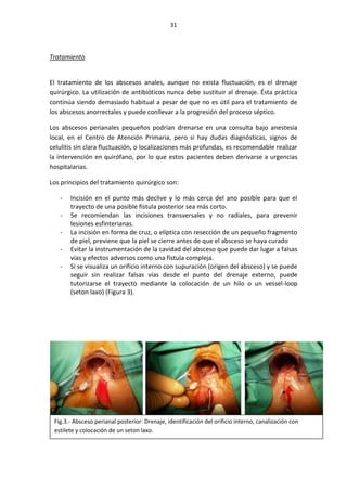Manual del-ggcp-de-proctología-para-atención-primaria-copia | PDF