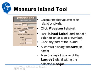 Manual Segmentation-3747 | PPT