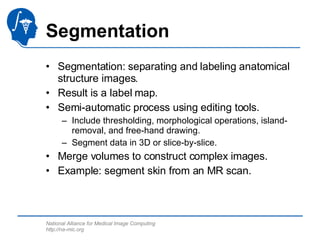 Manual Segmentation-3747 | PPT