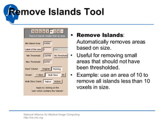Manual Segmentation-3747 | PPT