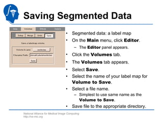 Manual Segmentation-3747 | PPT