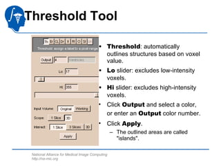 Manual Segmentation-3747 | PPT