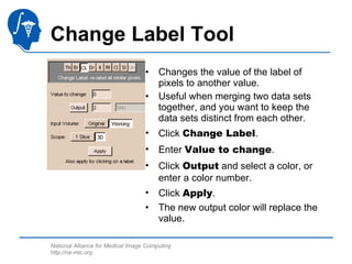 Manual Segmentation-3747 | PPT