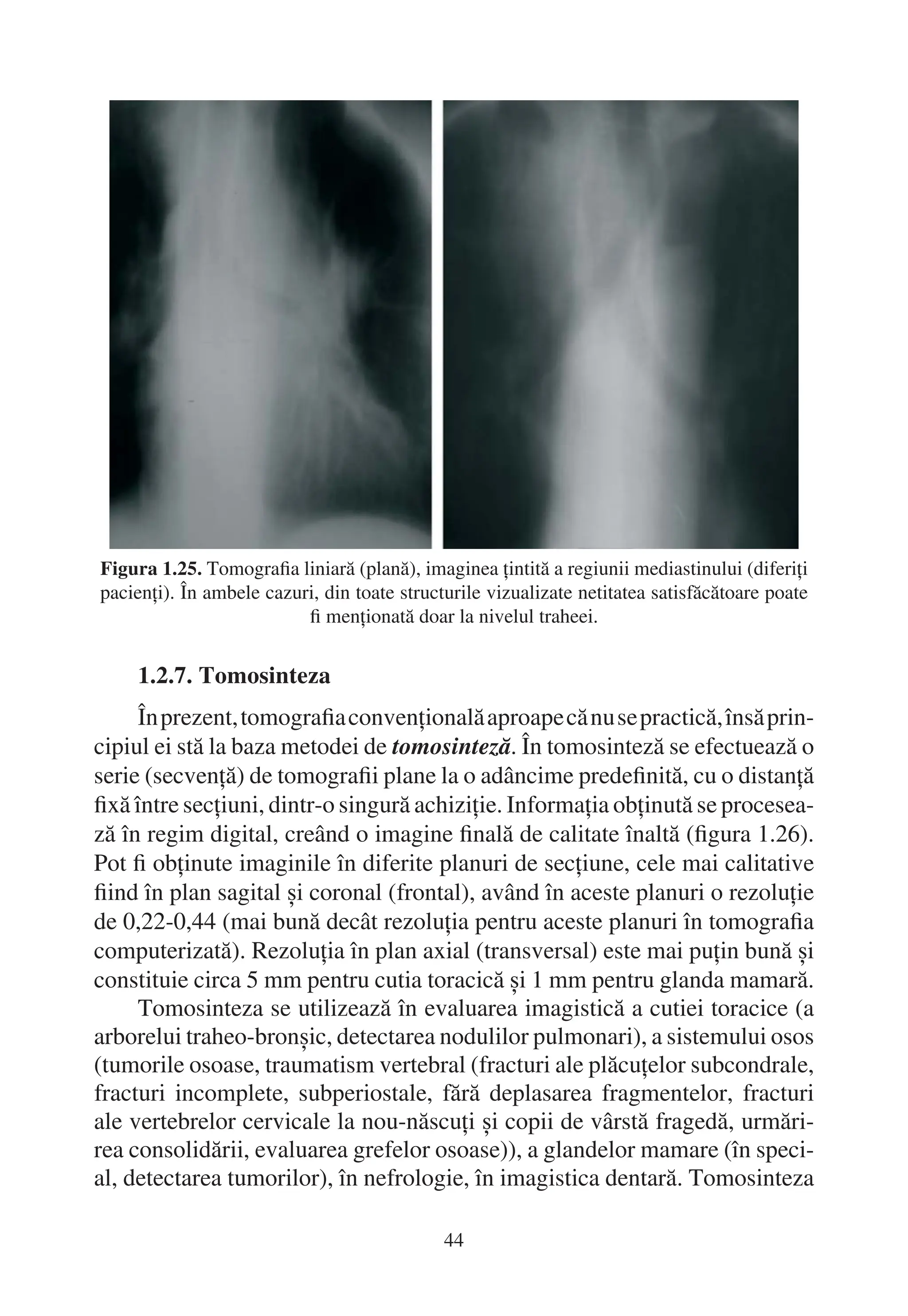 MANUAL Anul 3 Radiologie si radioprotectie_0.pdf